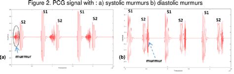 Figure 2 From Heart Sound Segmentation Based On Morphological