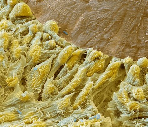 Amoeba Fruiting Body Sem Stock Image C0562239 Science Photo Library