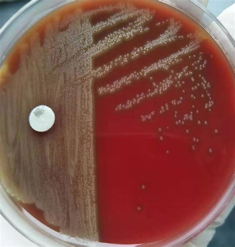 这样的肺炎链球菌，你见过吗？ 学术交流 检验视界 检验视界网