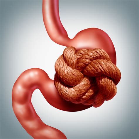 Constipation In The Elderly