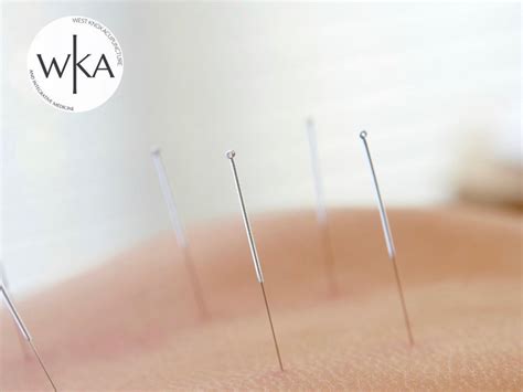 Acupuncture Fun Facts — West Knox Acupuncture And Integrative Medicine