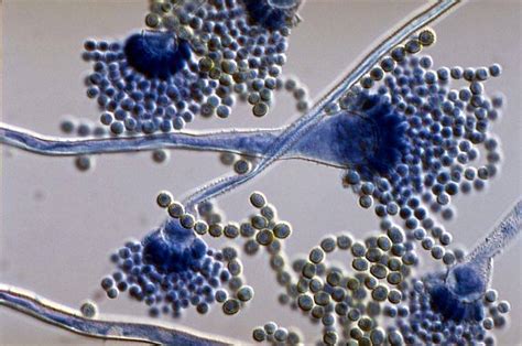 Aspergillus Flavus Under Microscope Medical Laboratories