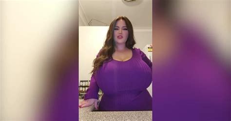 Woman Made £250k On Onlyfans Thanks To Rare Condition That Caused Her