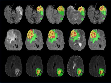The Cascaded Architecture Is Proved Useful By The Segmentation Results Download Scientific