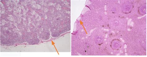 Histology Lymphatic System Respiratory System Flashcards Quizlet Histology Lymphatic System Respiratory System Flashcards Quizlet