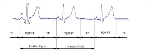 The Result Of Segmentation Of Ecg Signals Fragment Download