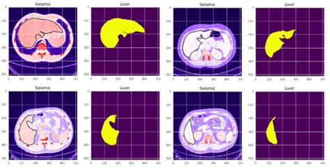 Dataset Images Samples Download Scientific Diagram