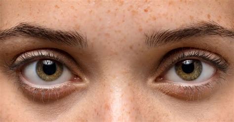 Science Behind Cosmelan Peel How Does It Reduce Hyperpigmentation