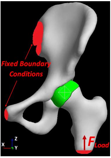 Pelvis Fixed Boundary Condition Showing The Boundary Conditions On The Download Scientific