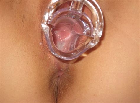 Angel Anna Set 226 Speculum 226 74 Porn Pic Eporner