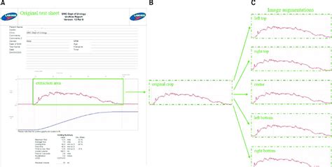 An Outline Of Uroflowmetry Graph Extraction And Data Augmentation Download Scientific Diagram