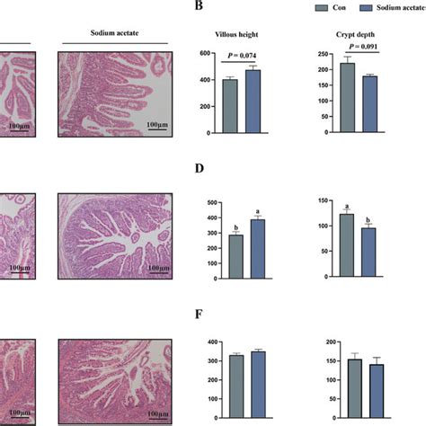 Effects Of Maternal Sodium Acetate Sa Addition Supplementation On Download Scientific Diagram