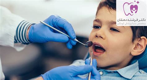 ترمیم و پرکردن دندان شیری کودکان دکتر فرشته دهقان