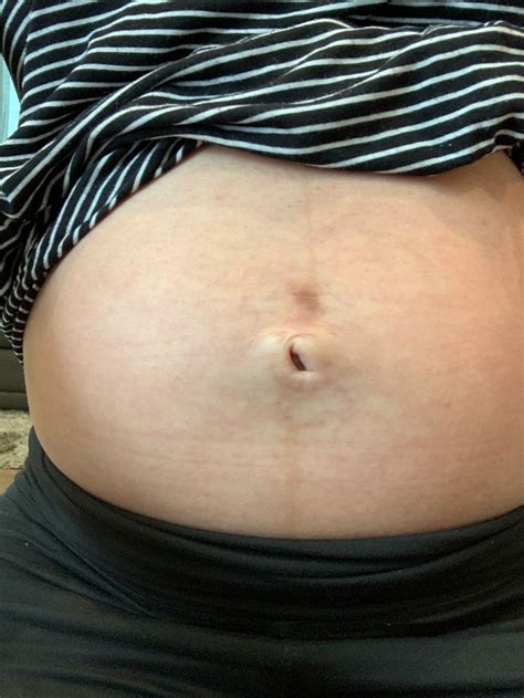 Belly Button Piercing Hole After Pregnancy