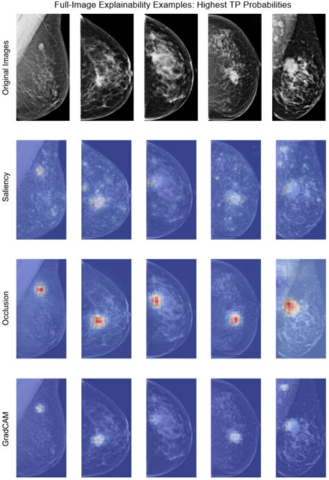Github Karla Sam Deep Learning Explainability For Breast Cancer Detection In Mammography A