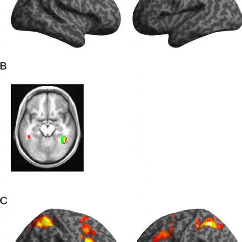 Regression Plot X Axis Less Index Y Axis Lesion Size In Cubic