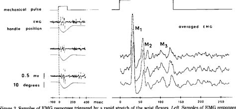 Figure 2 From Long Loop And Spinal Reflexes In Man During Preparation For Intended Directional