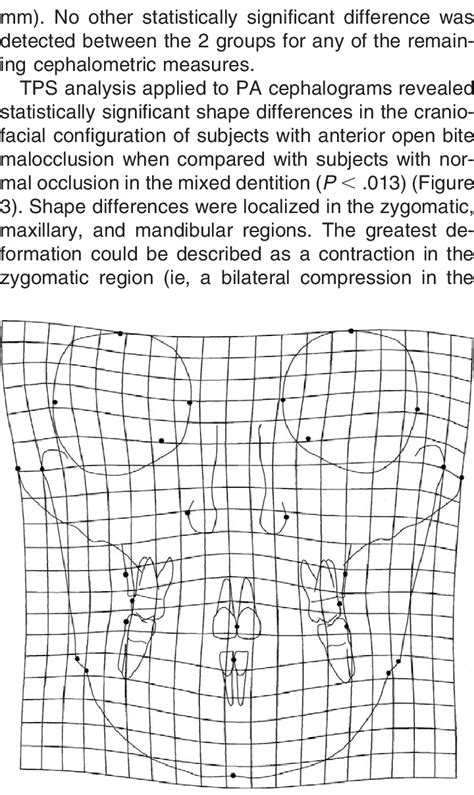 Thin Plate Spline TPS Graphical Display Of Shape Differences Between Download Scientific