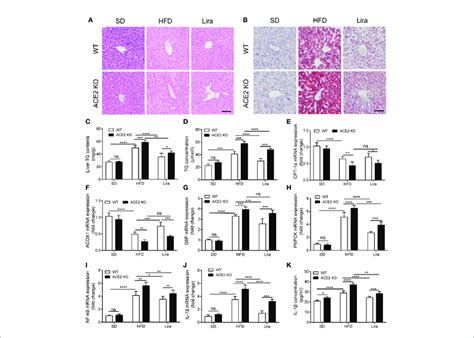 Liraglutide Ameliorates Hepatic Steatosis With Suppressed Download Scientific Diagram
