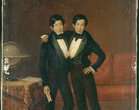 Gemelli Siamesi Tipi Cause E I Casi Più Famosi Della Storia Eroica