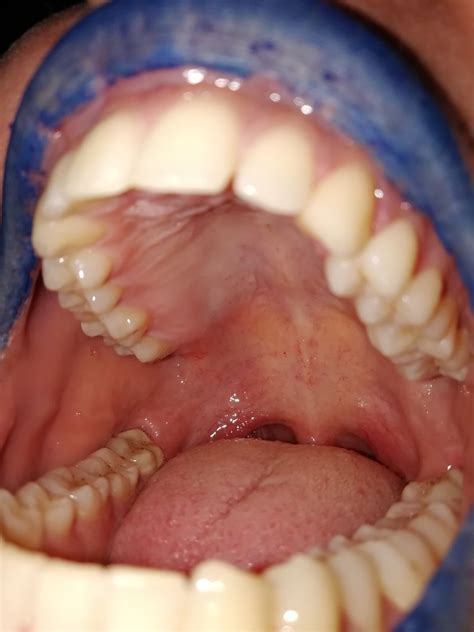 Miss Pretty Mouth Clips Sale