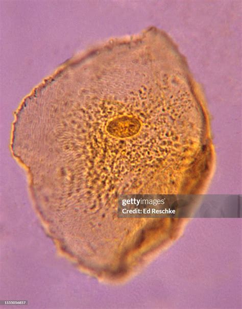 Cheek Epithelial Cell
