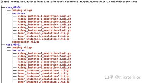 Nnu Net学习笔记系列1:安装和训练 知乎 Nnu Net学习笔记系列1:安装和训练 知乎