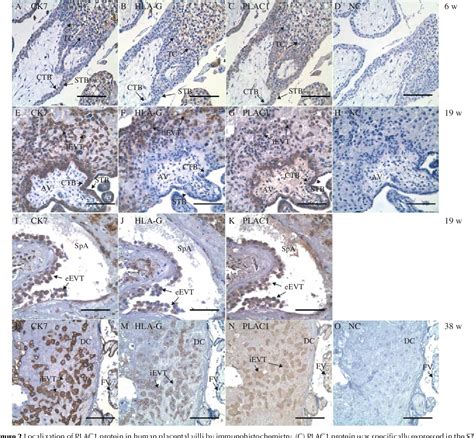 Figure 2 From Role Of Placenta Specific Protein 1 In Trophoblast