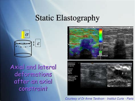 Ppt A New Ultrasound Modality Us Elastography Powerpoint