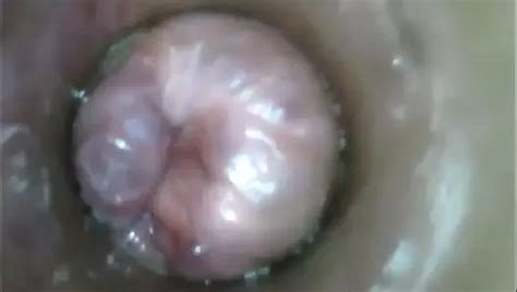 Endoscope XHamster
