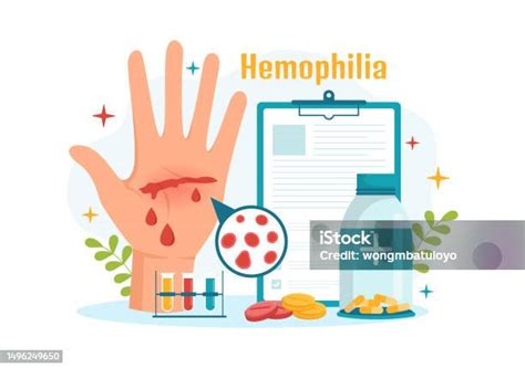 혈우병 벡터 일러스트레이션 의사가 부상당한 무릎 또는 관절 및 혈액 질환을 검사하는 의료 플랫 만화 손으로 그린 템플릿 건강