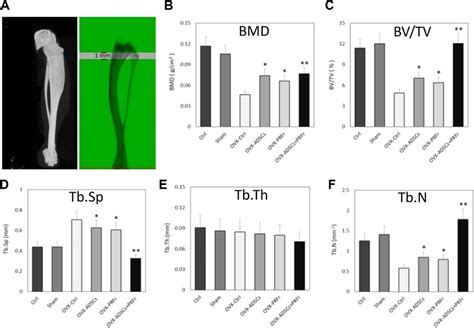 A Schematic Representation Of The Trabecular Bone Area Using Micro Ct Download Scientific