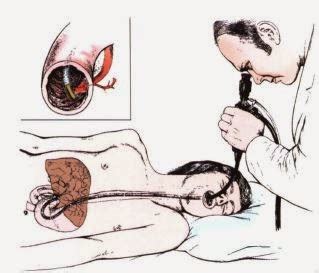 Endoscopy ERCP Procedure Radiologic Tech Guide RadTechOnDuty