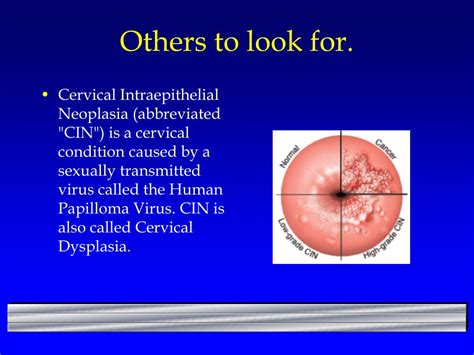 Ppt Colposcopy Powerpoint Presentation Free Download Id1703513
