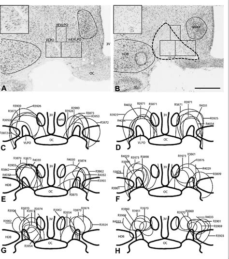 Figure 1 From Metabolic Effects Of Chronic Sleep Restriction In Rats Semantic Scholar