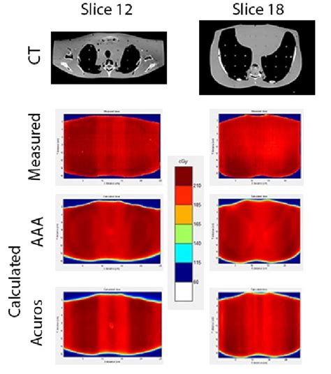 CT Images Of Slices And Along With The Measured Film Dose And Download Scientific