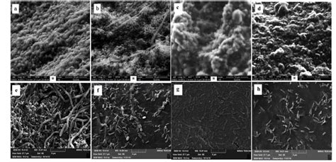 Environmental Scanning Electron Microscope Esem Observations Of