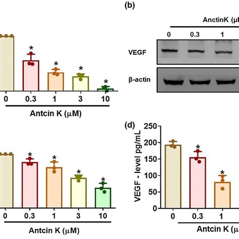 Levels Of Vegf Expression In Human Synovial Tissue A Levels Of Vegf Download Scientific