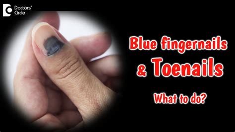Why Are My Fingernails Blue At The Base At Maxine Quiroz Blog