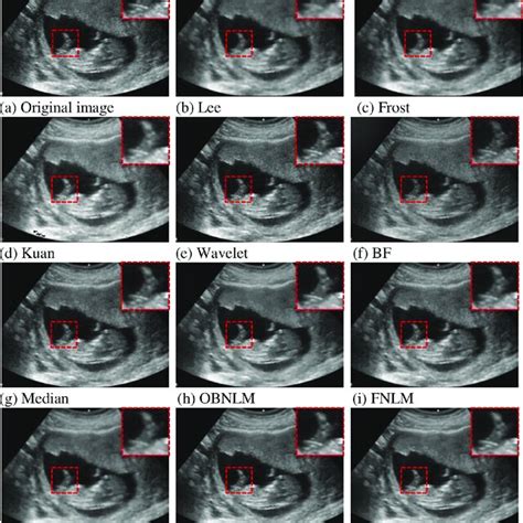 Pdf Frequency Division Denoising Algorithm Based On Vif Adaptive 2d