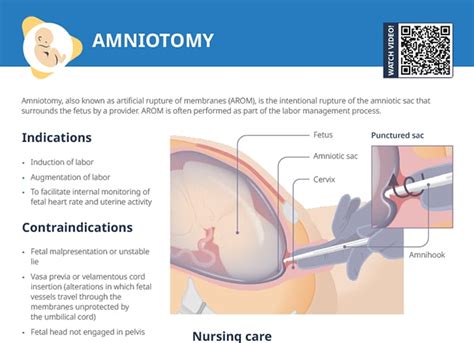 Amniotomy [ Free Cheat Sheet] Lecturio Nursing