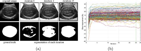 A Intermediate Rendering And Segmentation Result B Dice