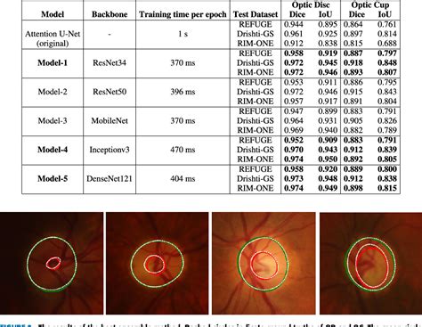 Figure 1 From Glaucoma Identification Using Convolutional Neural