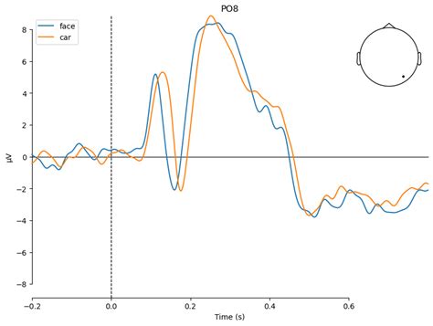 Pipeline Introduction To EEG Analysis