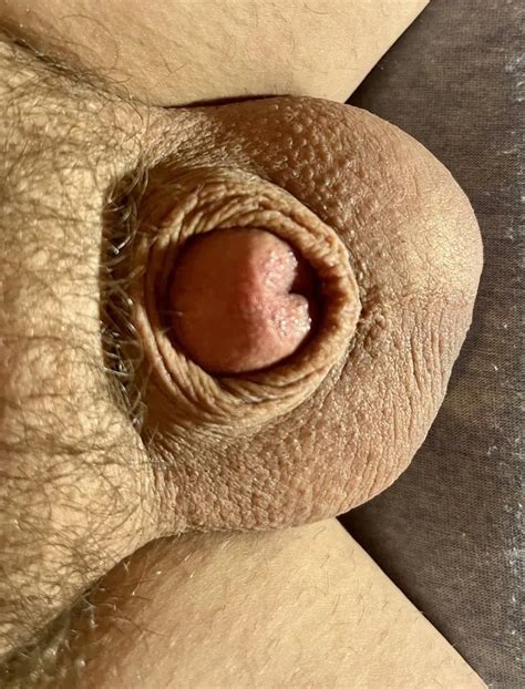 Tiny Penis Micro Cock Inverted Cock Photos 8 Pics Xhamster