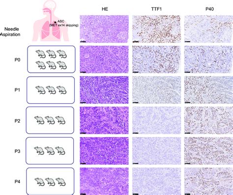 Xenograft Model Of ASC Tumor Tissue Sample Of A Patient Diagnosed With Download Scientific