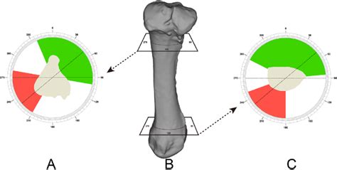 Safety Zone And Danger Zone In Tibia Treatment Green Indicates Safety Download Scientific