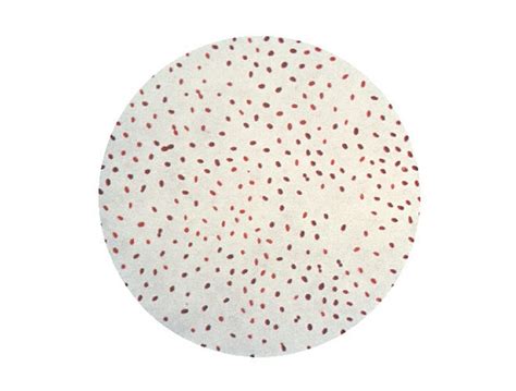 Brucellosis Pictures Biological Weapons