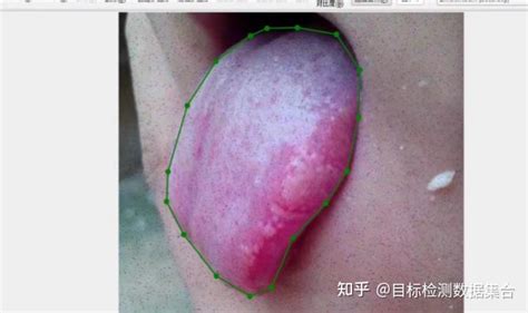 基于unet模型的舌苔语义分割：使用unet模型训练舌苔语义分割数据集 知乎