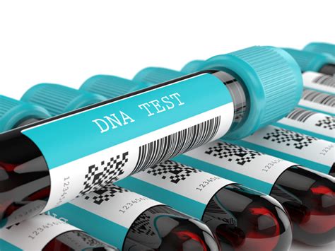 Forensic Dna Testing Company San Diego Bld Forensics